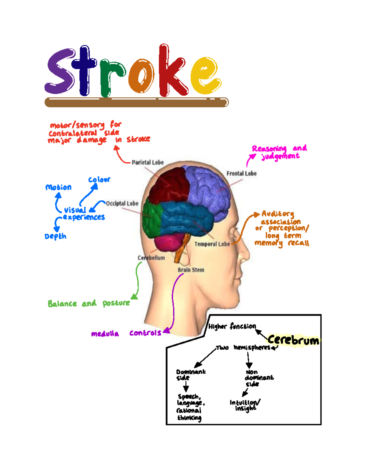 Stroke - lecture notes - stir like ily motorlsensory for contralateral ...