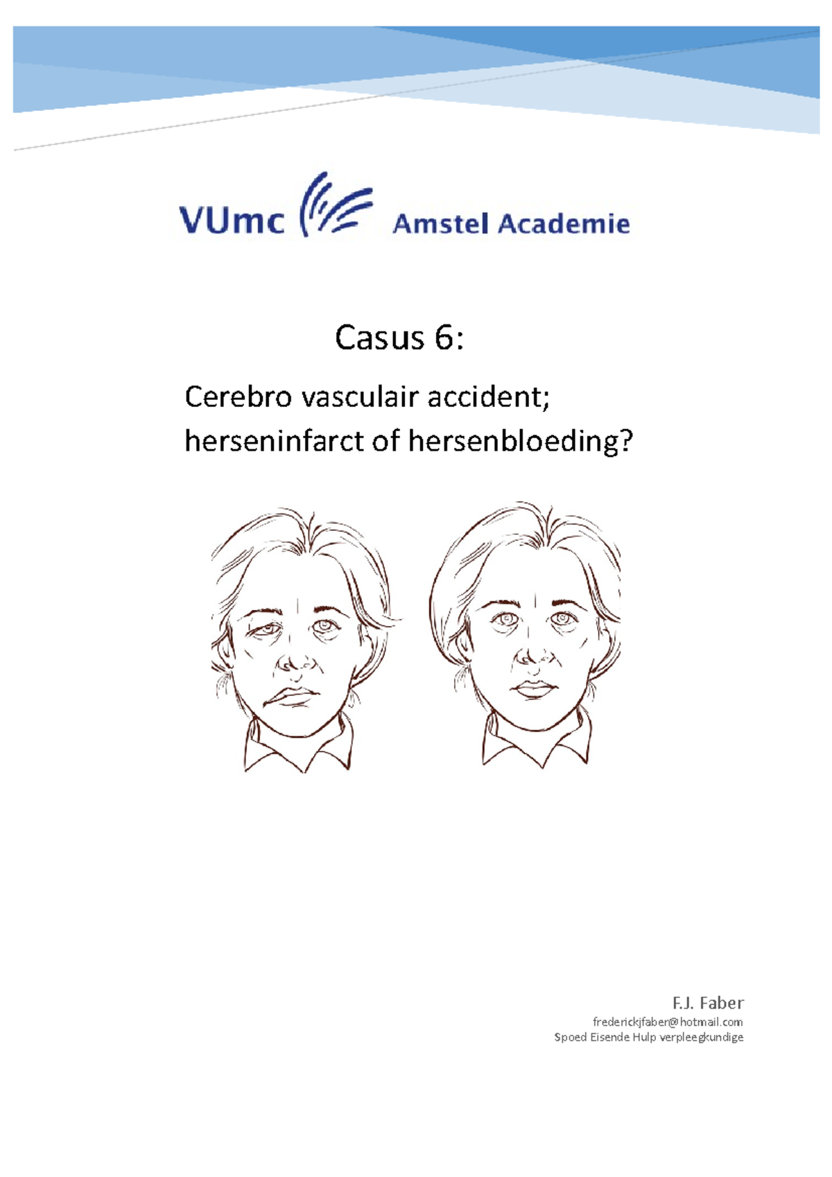 Casus 6 - CVA; hersenbloeding of herseninfarct - Acute geneeskunde ...