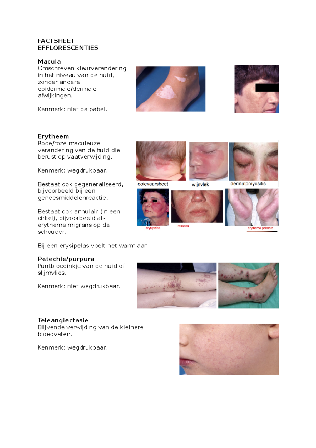 Fact sheets Efflorescenties - FACTSHEET EFFLORESCENTIES Macula ...