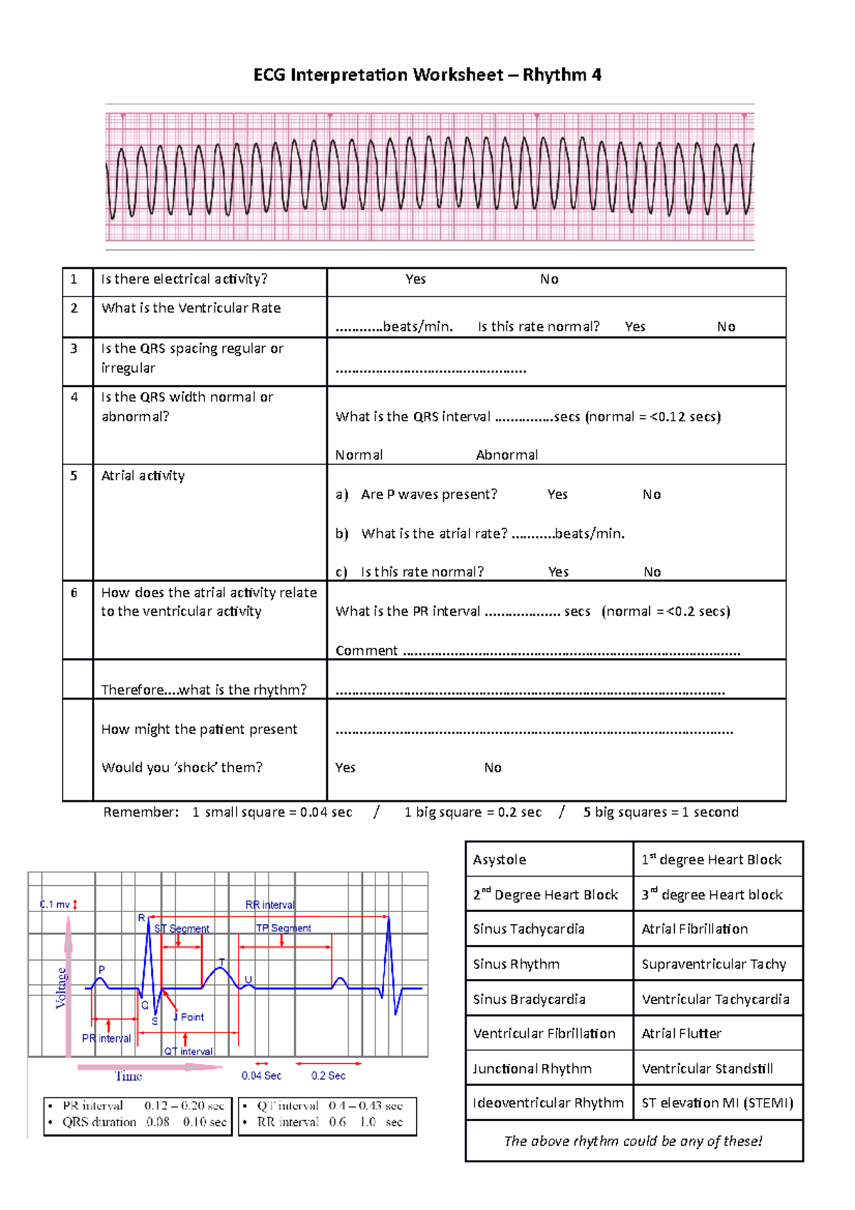 Rhythm 4 - ECG Interpretation Worksheet – Rhythm 4 1 Is there ...