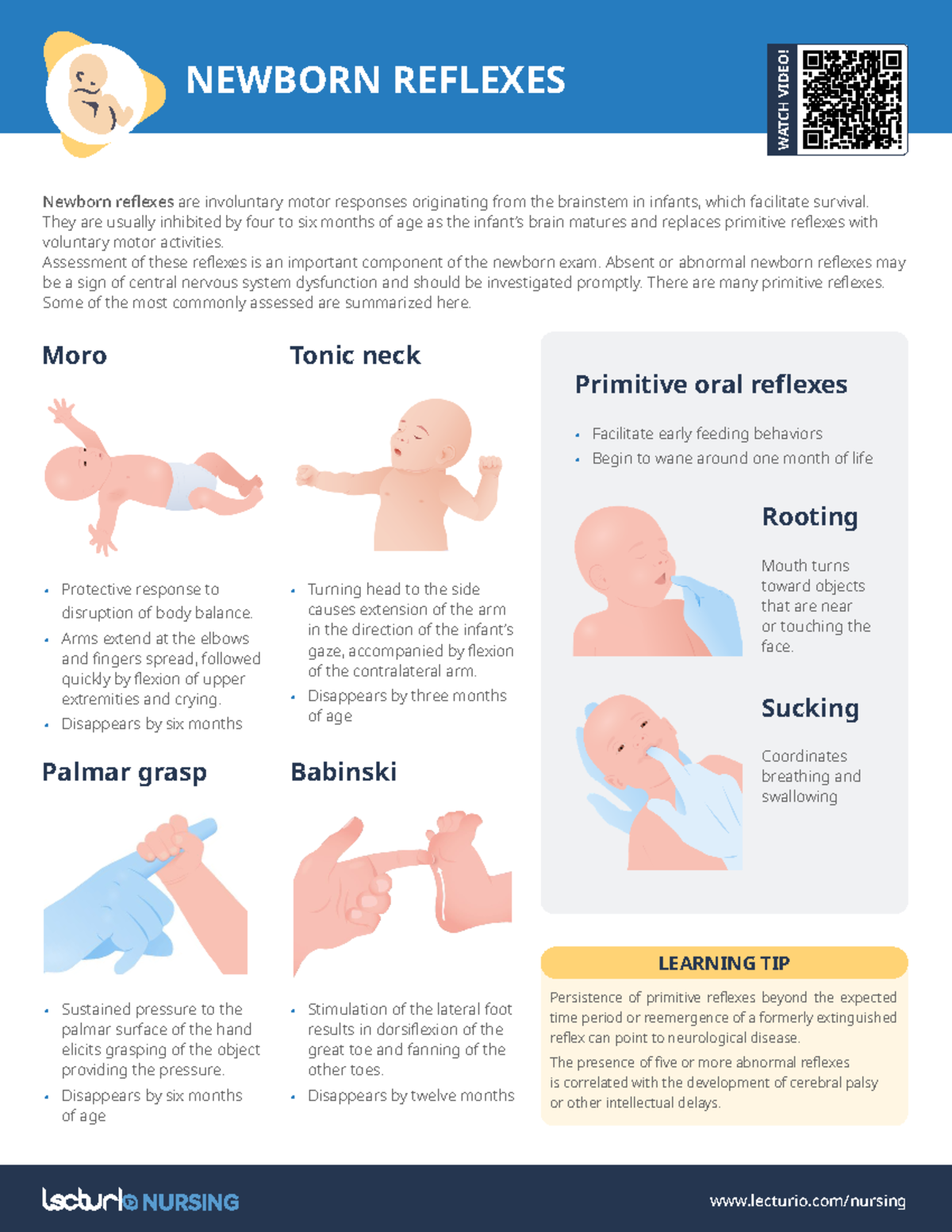Nursing CS Newborn Reflexes 02 - lecturio/nursing Newborn reflexes are ...