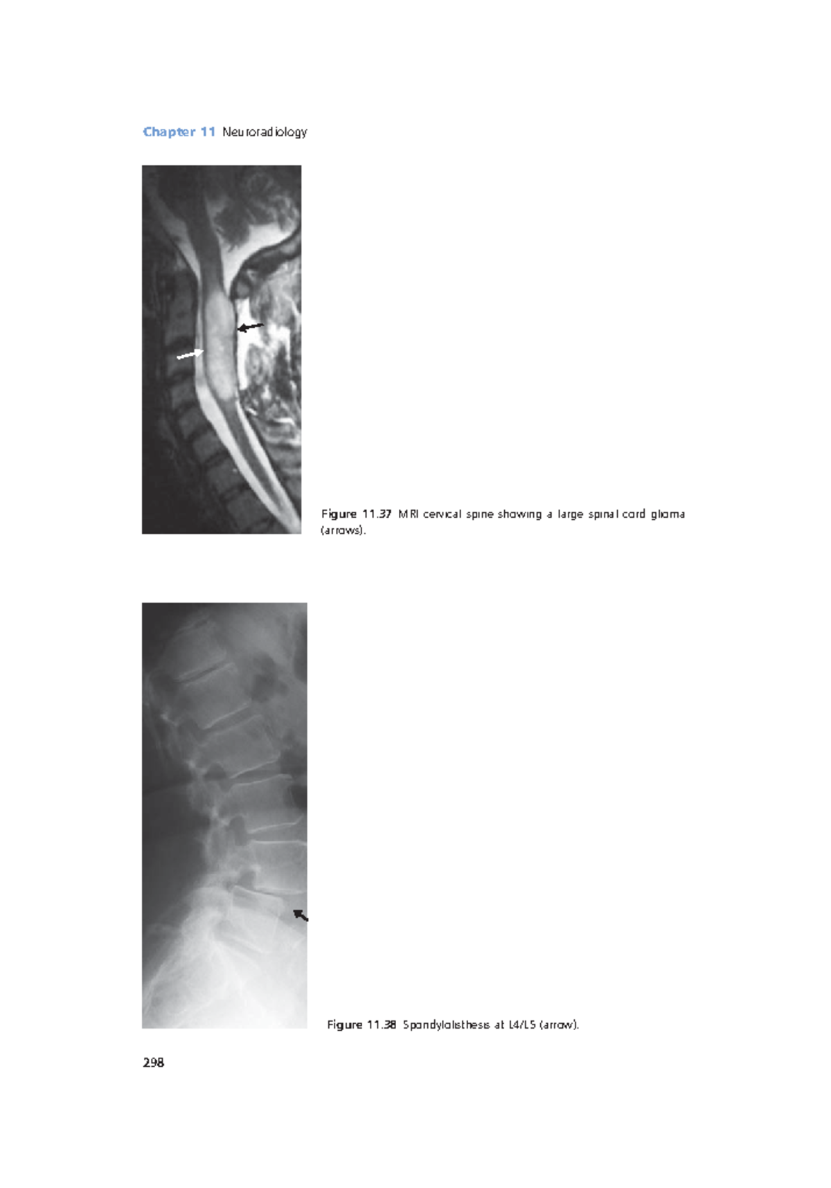 Radiology Lecture Notes pdf (100) - Chapter 11 Neuroradiology 298 ...