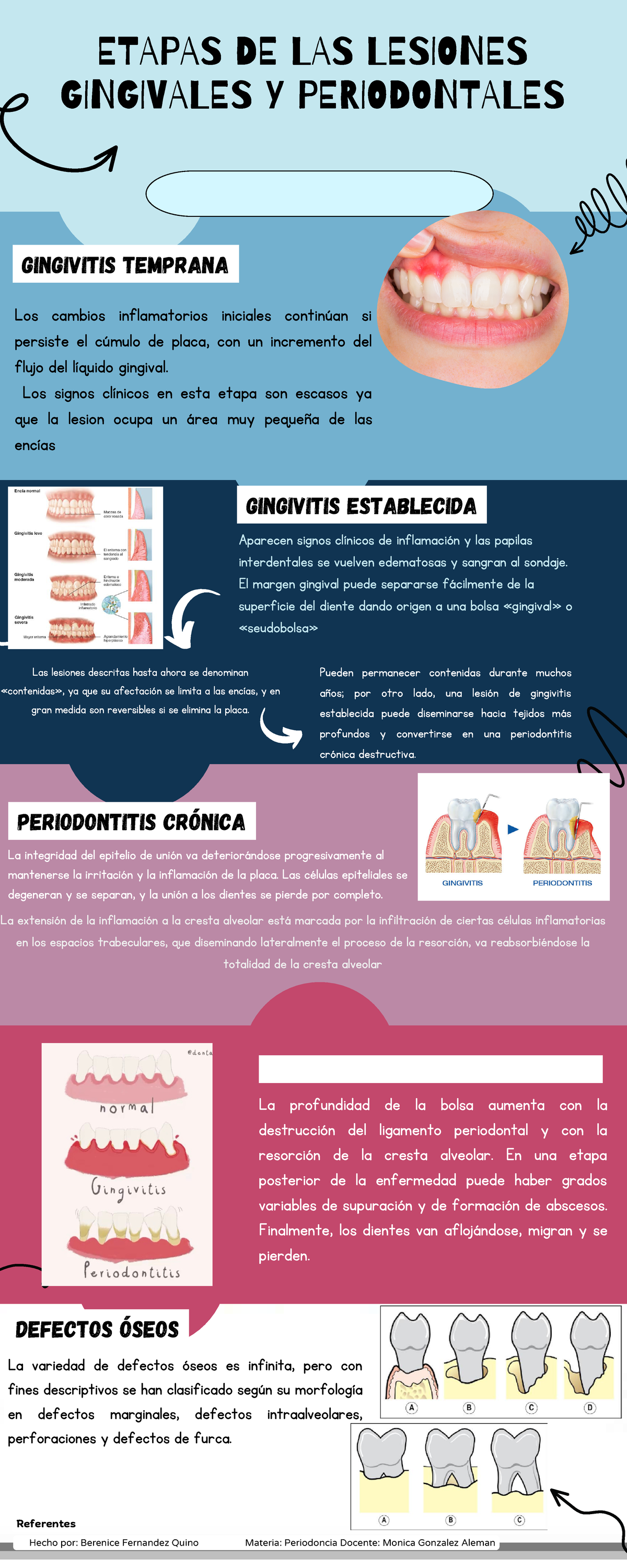 Etapas de las Lesiones Gingivales y Periodontales - ETAPAS DE LAS ...