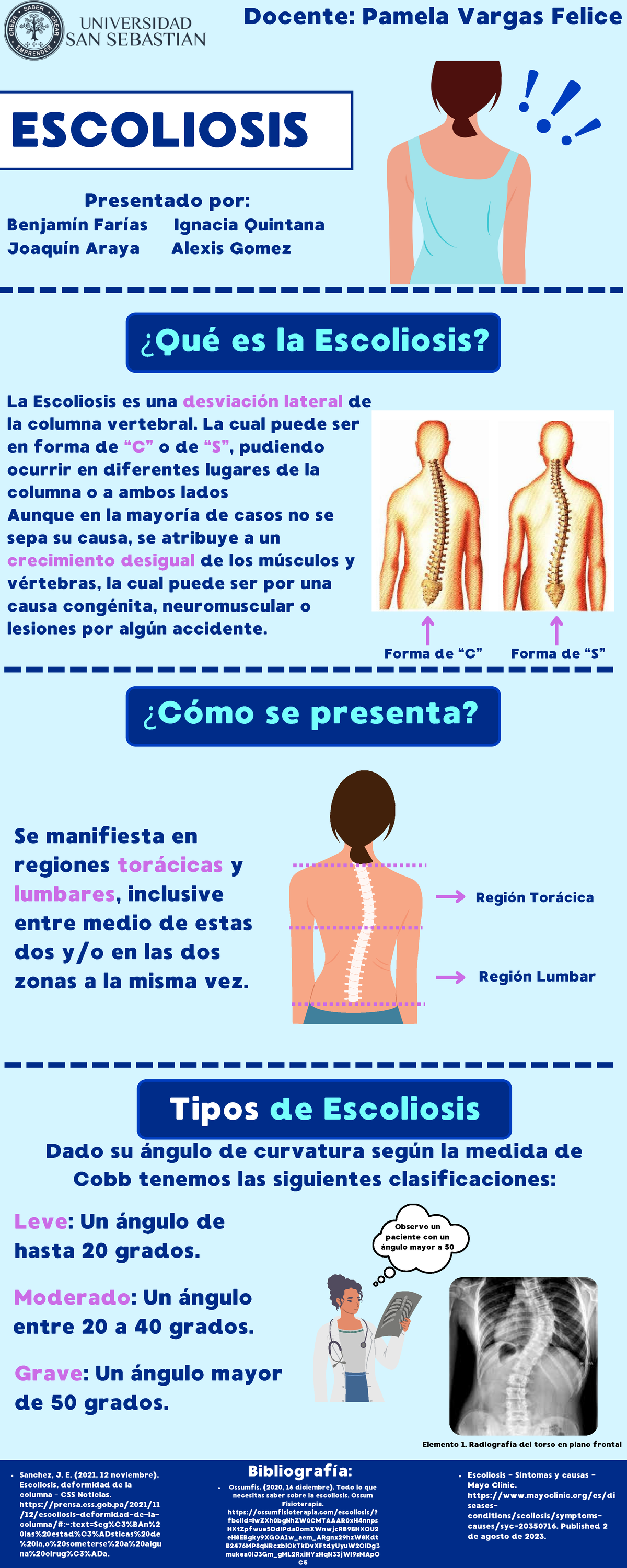 Infografía sobre la Escoliosis - ESCOLIOSIS Presentado por: Benjamín ...