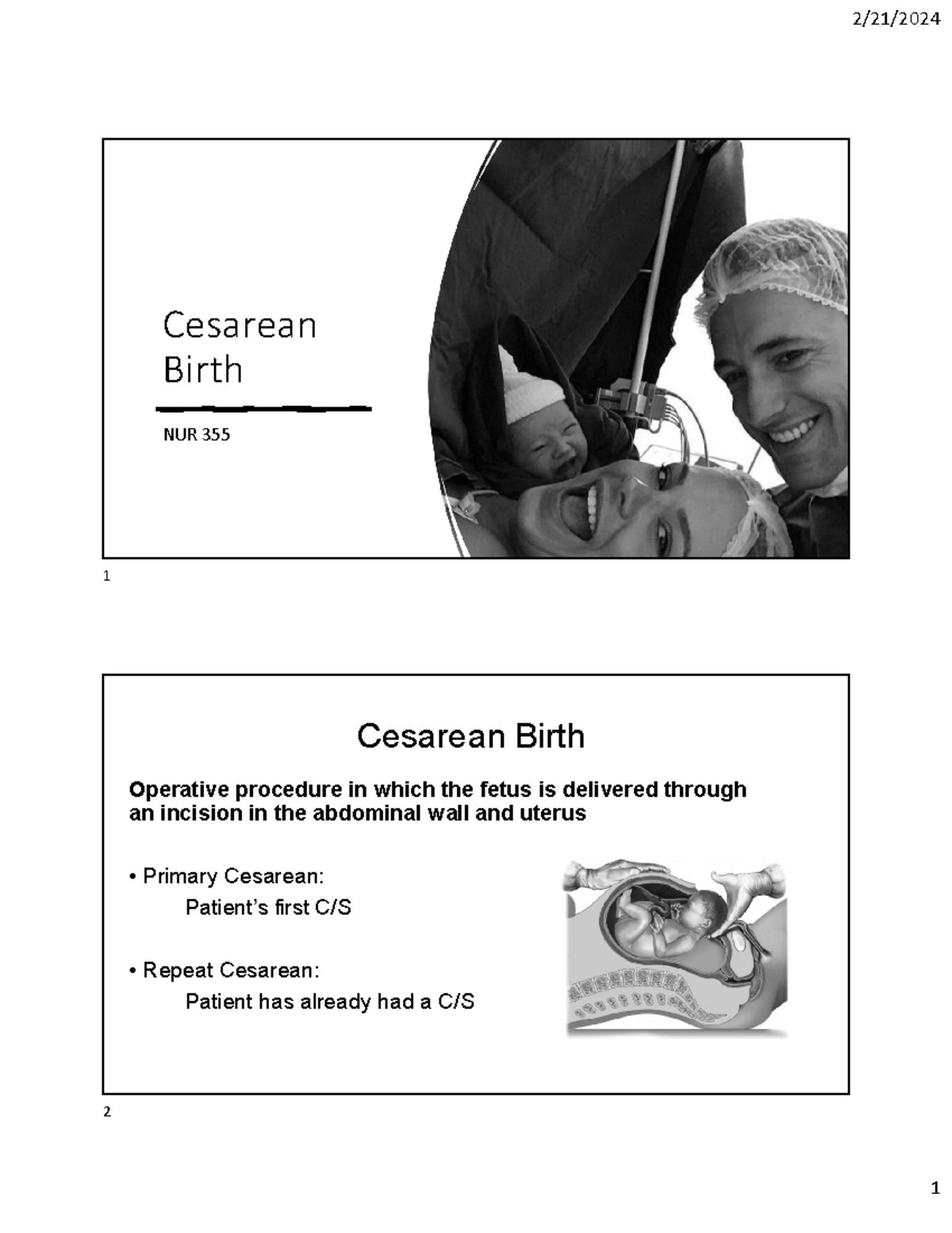 NUR 355 Cesarean Birth Printout - Cesarean Birth NUR 355 Cesarean Birth Operative procedure in ...