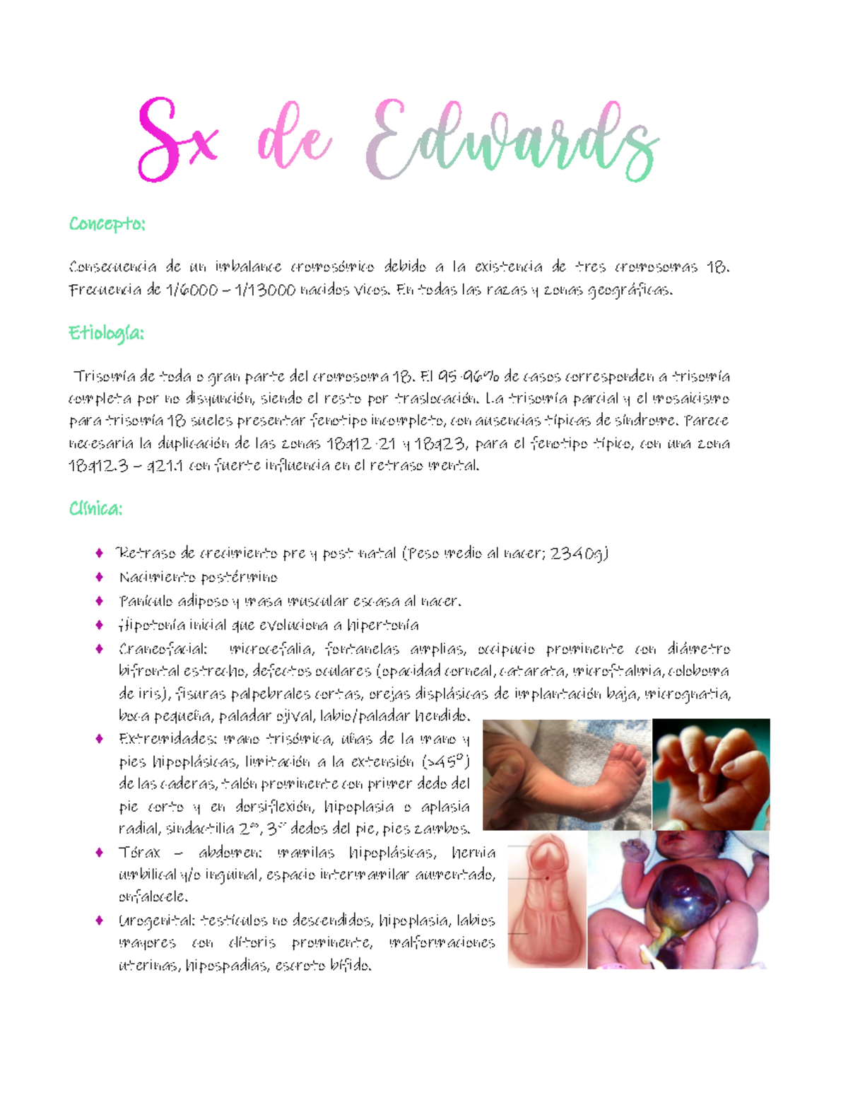 Síndrome de Edwards - Trisomía 18 - Concepto: Consecuencia de un ...