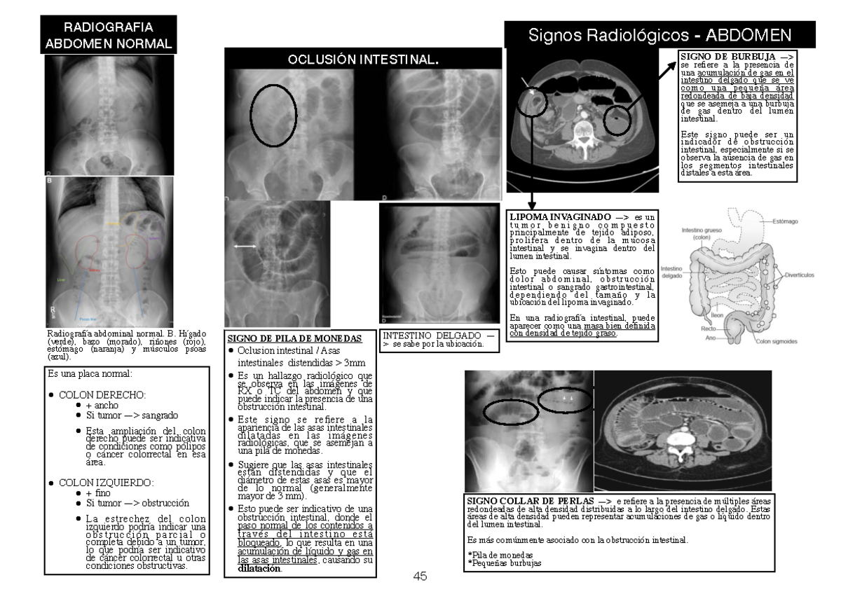 MAPS - Signos Radiológicos - Abdomen - Signos Radiológicos - ABDOMEN ...