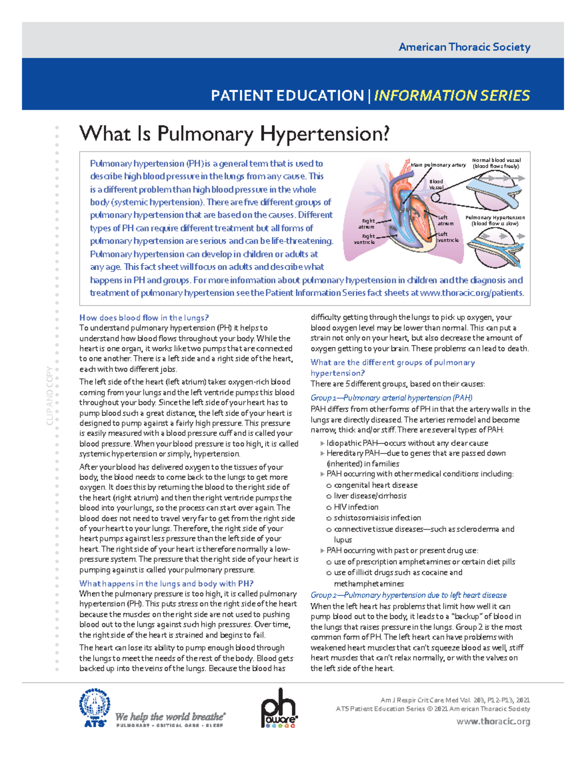 Pulmonary-hypertension - American Thoracic Society PATIENT EDUCATION ...