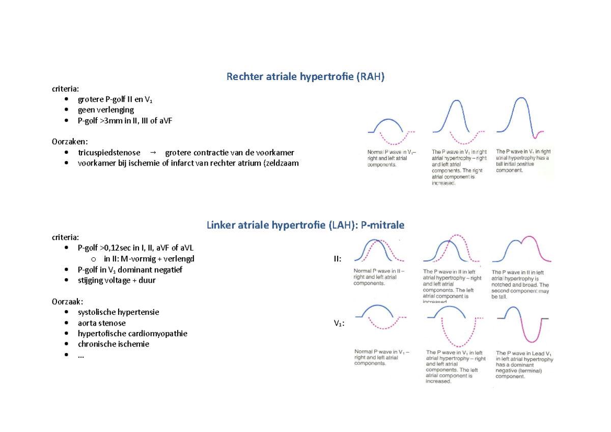 Afwijkingen ECG (lang) - Rechter atriale hypertrofie (RAH) criteria ...