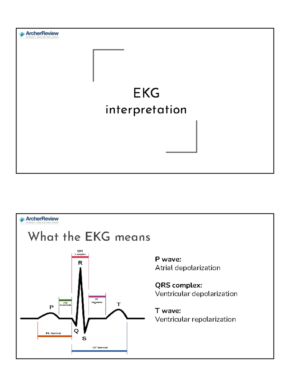 18.EKG interpretation - EKG interpretation What the EKG means P wave ...