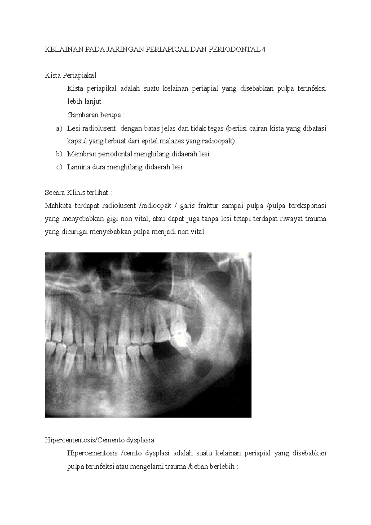 Kelainan Pada Jaringan Periapical Dan Periodontal 4 - KELAINAN PADA ...