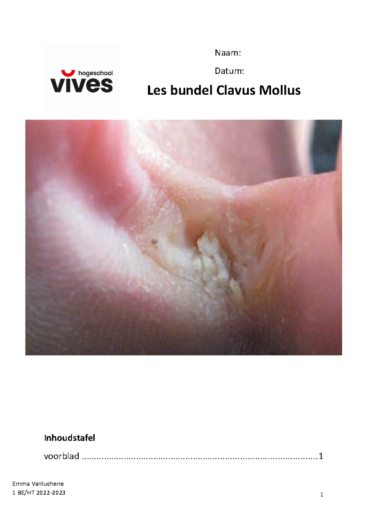 Les bundel Clavus mollus met oefeningen - Les bundel Clavus Mollus ...