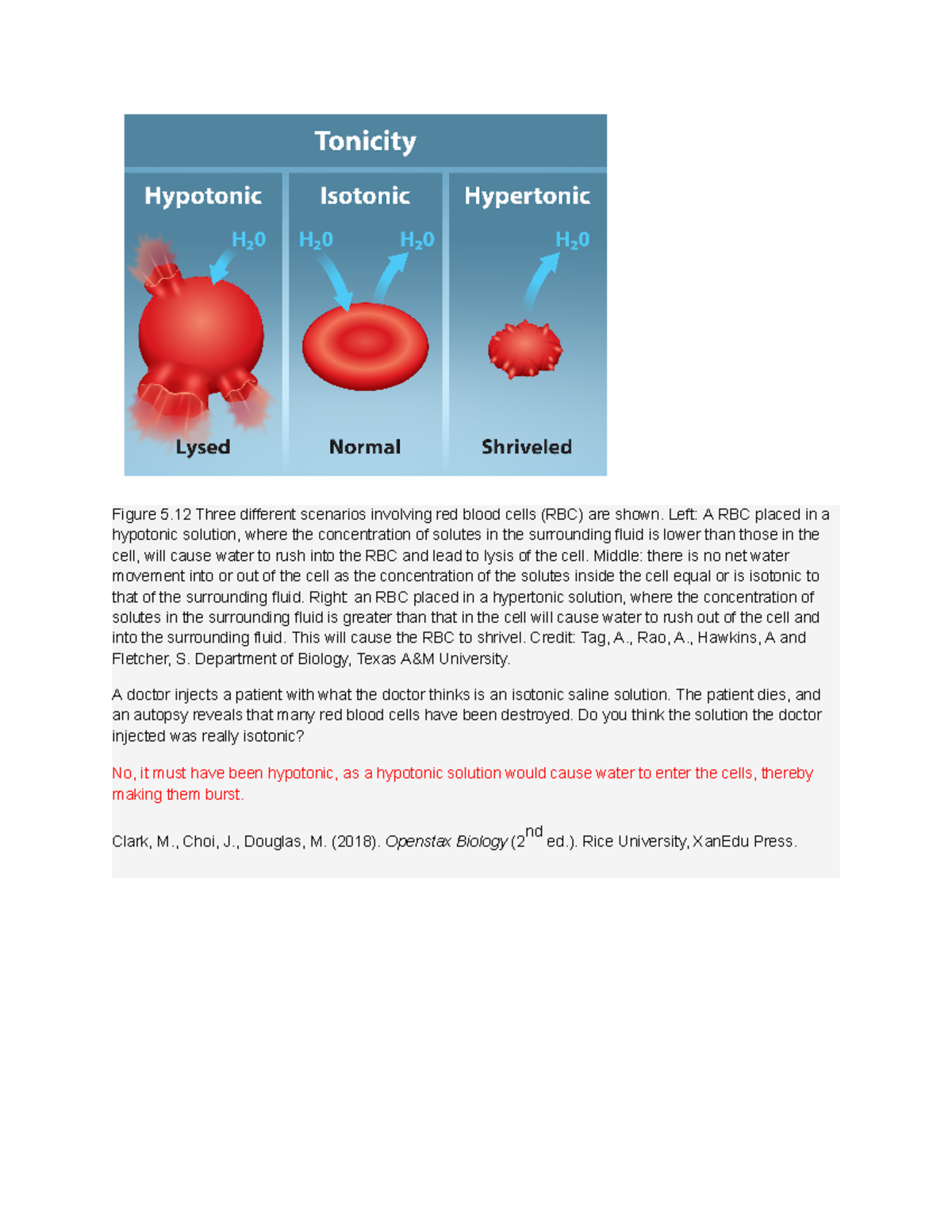Tonicity - An assignment - Figure 5 Three different scenarios involving red blood cells (RBC ...