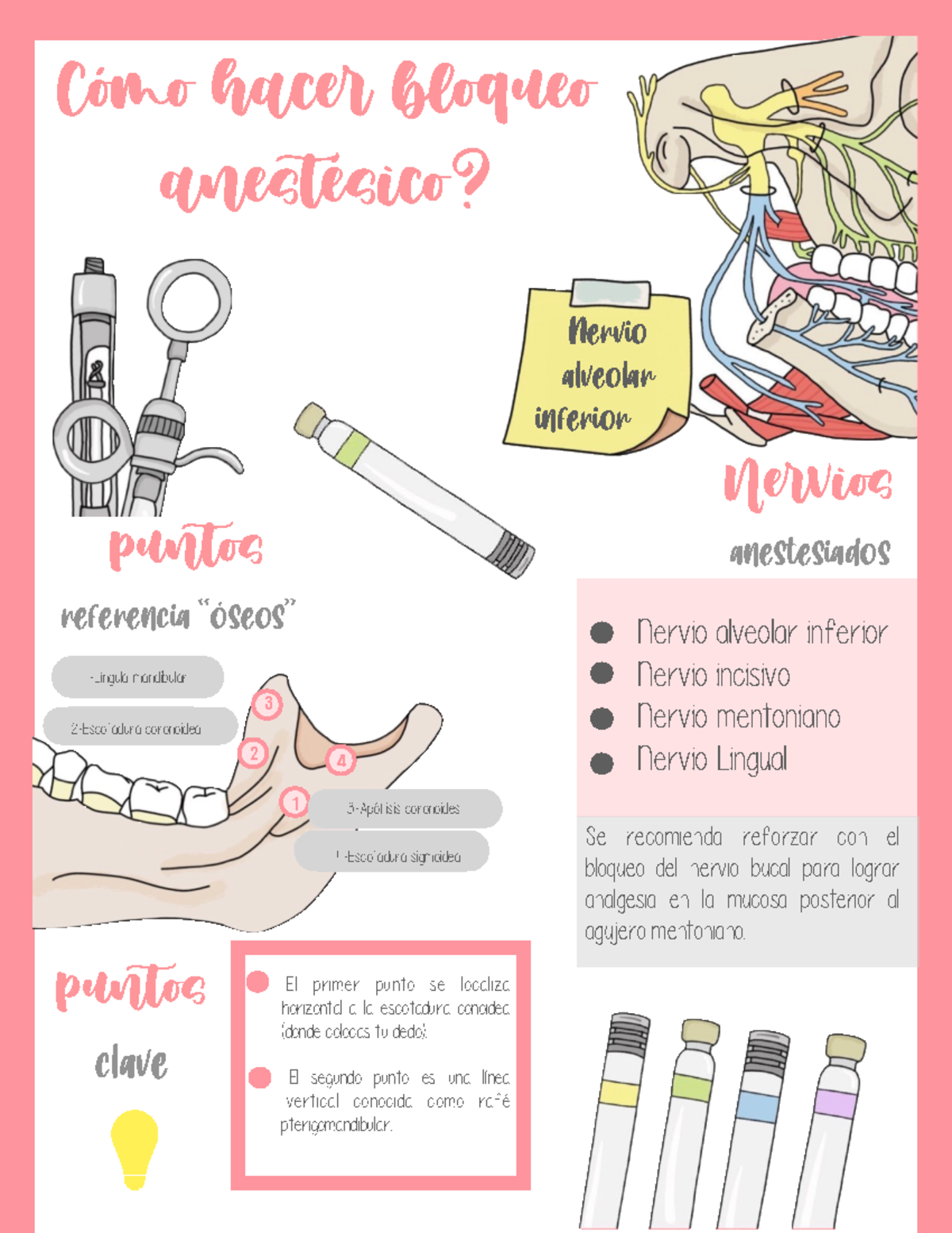 Infografía cario - Cómo hacer bloqueo anestésico? Nervio alveolar ...