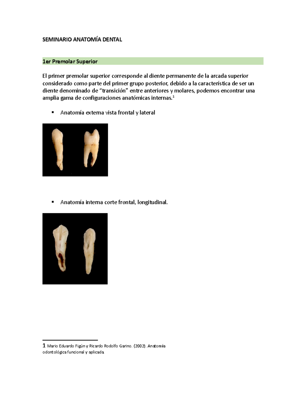 Premolar Superior Anatomia - SEMINARIO ANATOMÍA DENTAL 1er Premolar ...