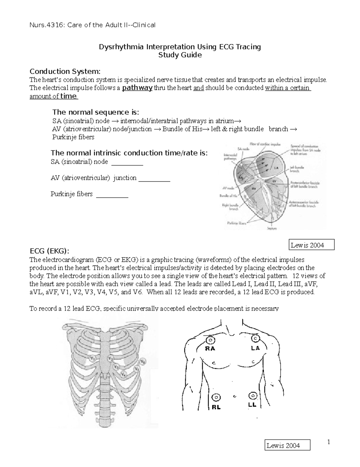 4316 Dysrhythmia skill lab study guide - Dysrhythmia Interpretation ...