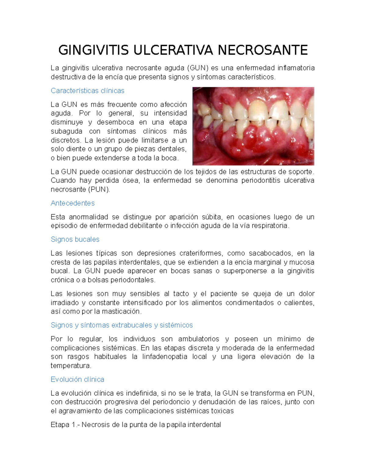 Gingivitis Ulcerativa Necrosante - Características clínicas La GUN es más frecuente como ...
