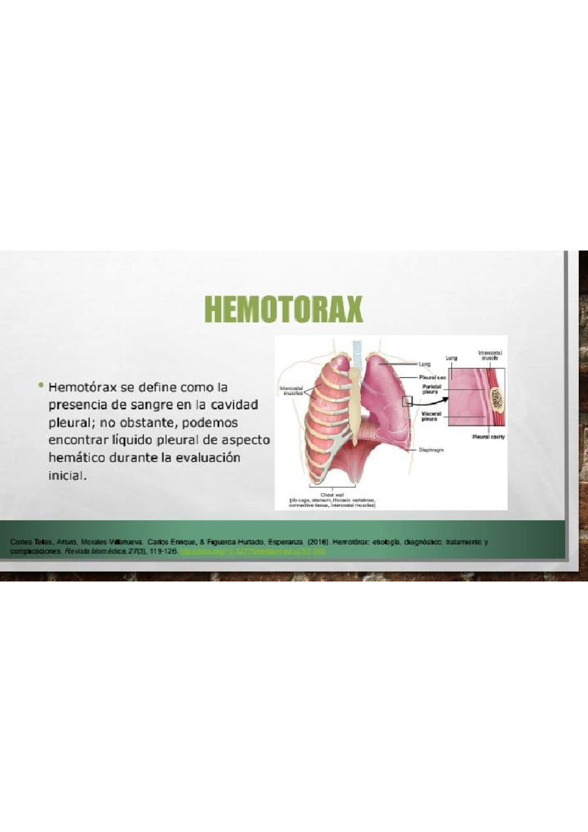 Hemotórax - Apuntes de repaso - ANATOMÍA PATOLÓGICA - Studocu