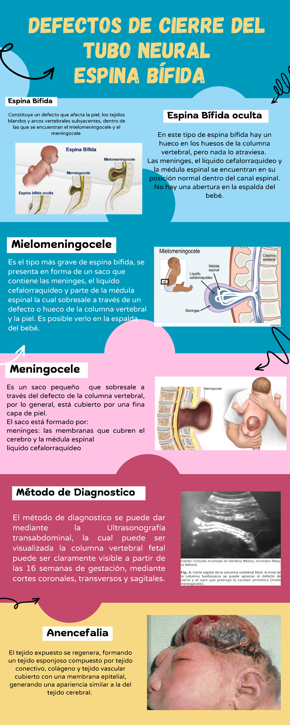 Grupo 5 - Defectos del cierre del tubo neural - DEFECTOS DE CIERRE DEL ...
