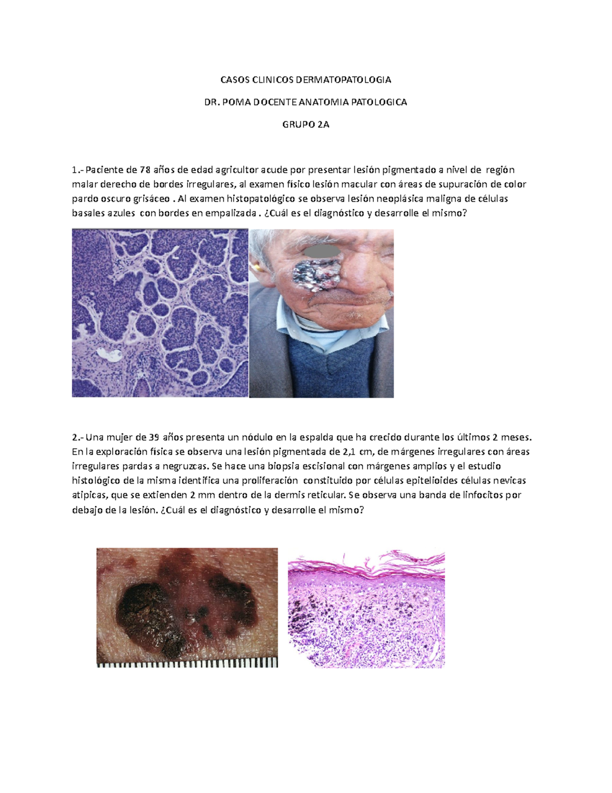 Casos Clinicos Dermatopatologia 2023 - CASOS CLINICOS DERMATOPATOLOGIA ...