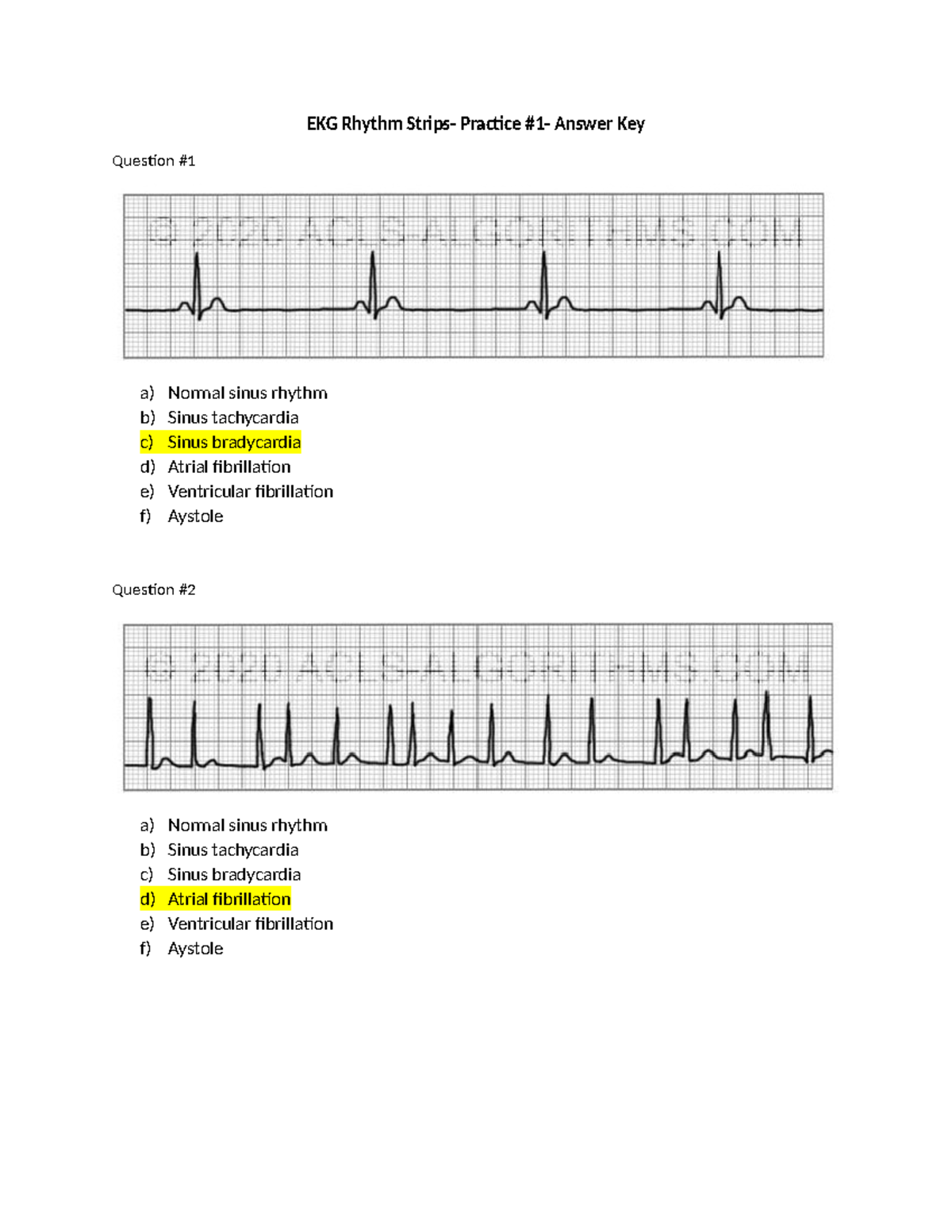 EKG Rhythm Strips-1- Answer Key - EKG Rhythm Strips- Practice #1 ...