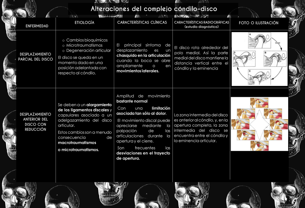 Alteraciones del complejo cóndilo-disco - Alteraciones del complejo ...