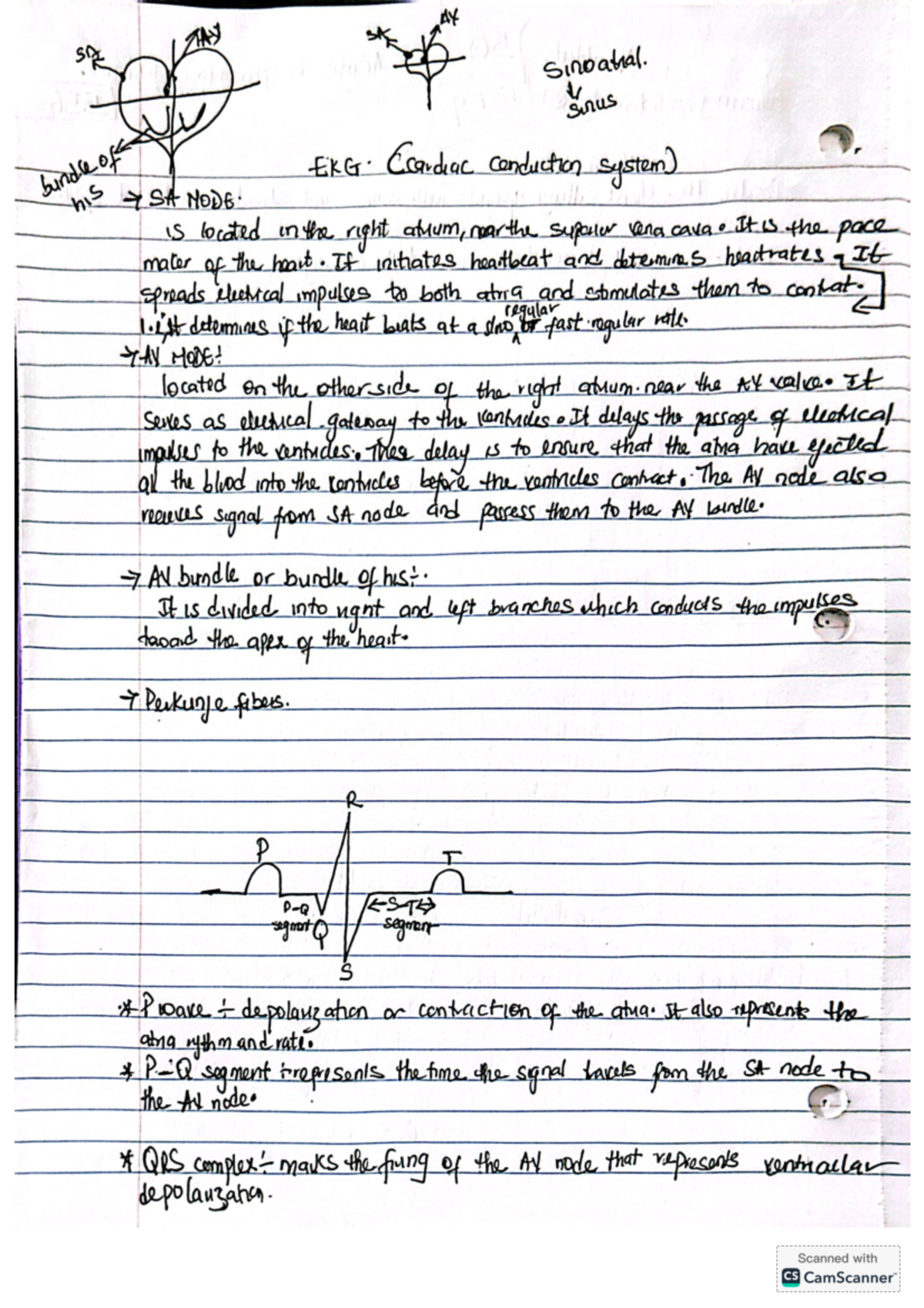 Complex Med-surg perfusion note - At SB Sinoathal. sinus bundle of EKG ...