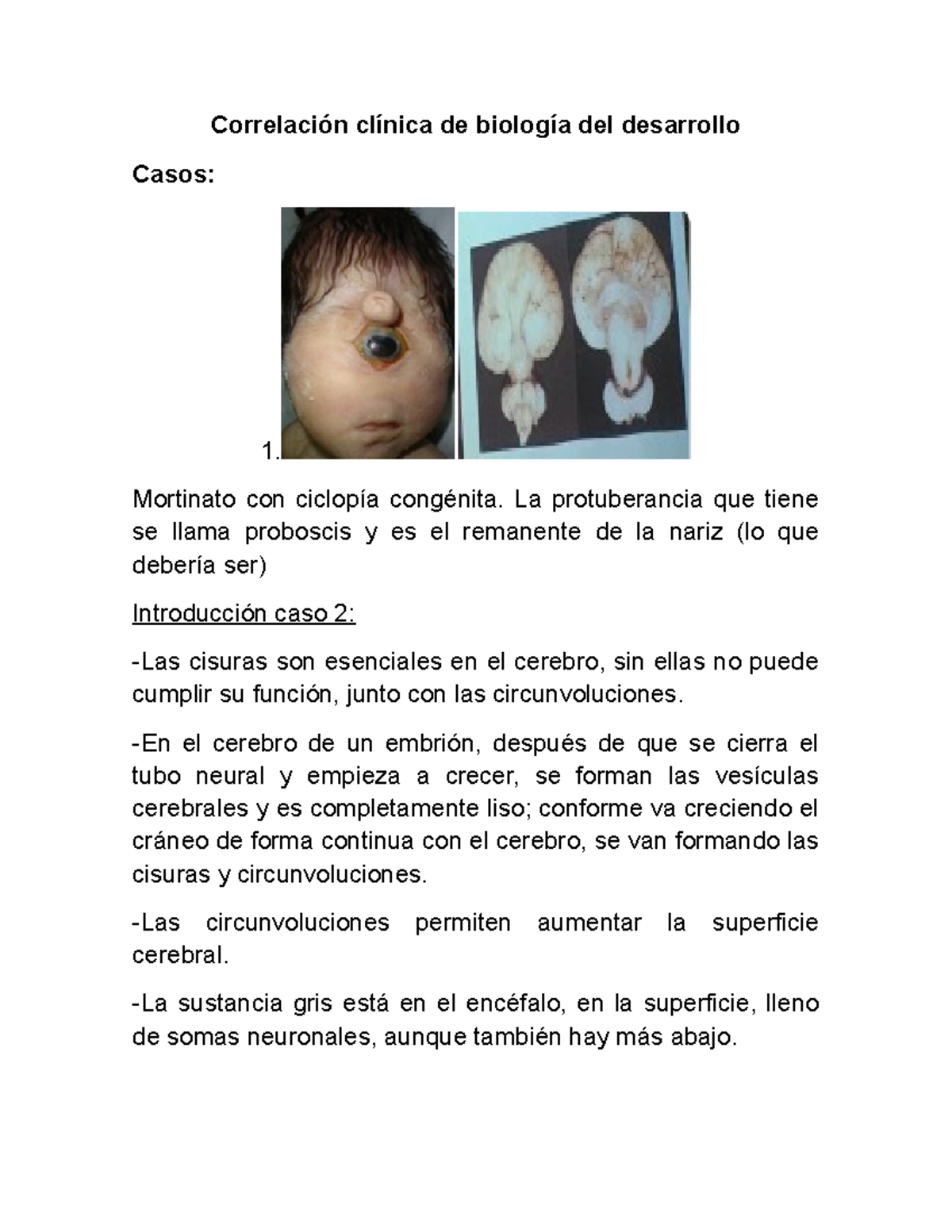 Correlación clínica de biología del desarrollo - Mortinato con ciclopía congénita. La ...