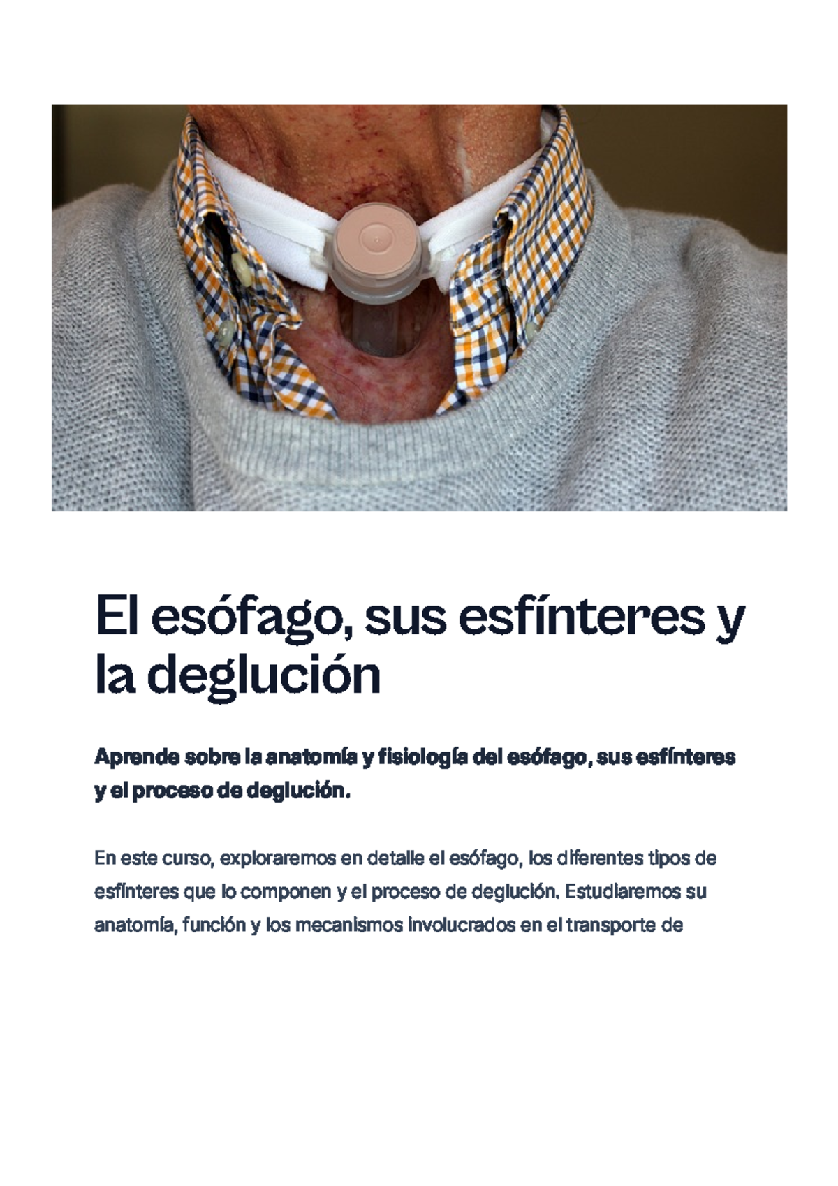 El esofago sus esfinteres y la deglucion - El esófago, sus esfínteres y ...