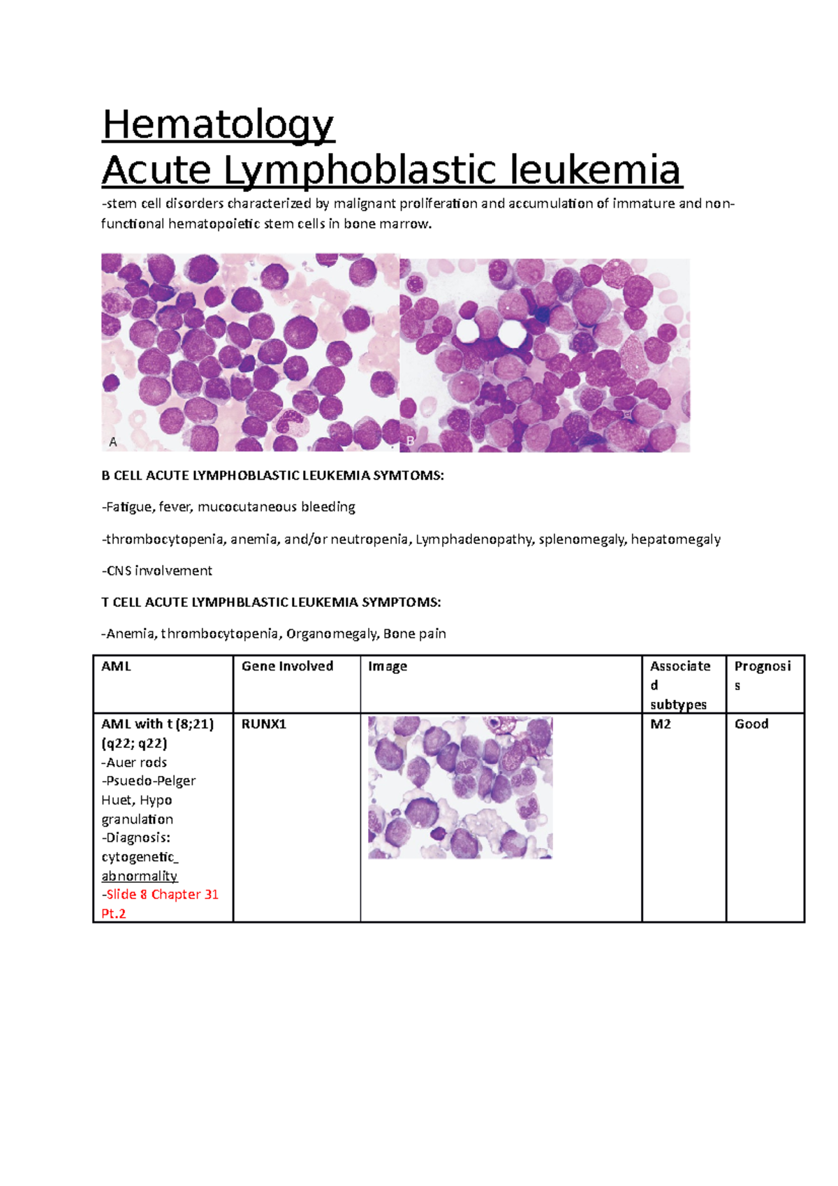 Hematology.docx 1.docx 1.docx A - Hematology Acute Lymphoblastic ...