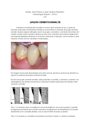 Periodontia - Anatomia e histologia do Periodonto - Warning: TT: undefined function: 32 ...