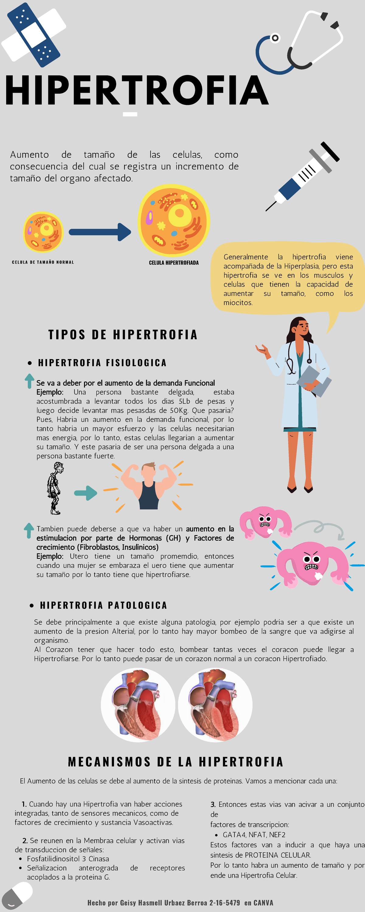 Hipertrofia Biatrial é Perigoso - BRAINCP