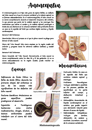 ANENcefalia EMBRIOLOGIA - Anencefalia La anencefalia es un defecto ...