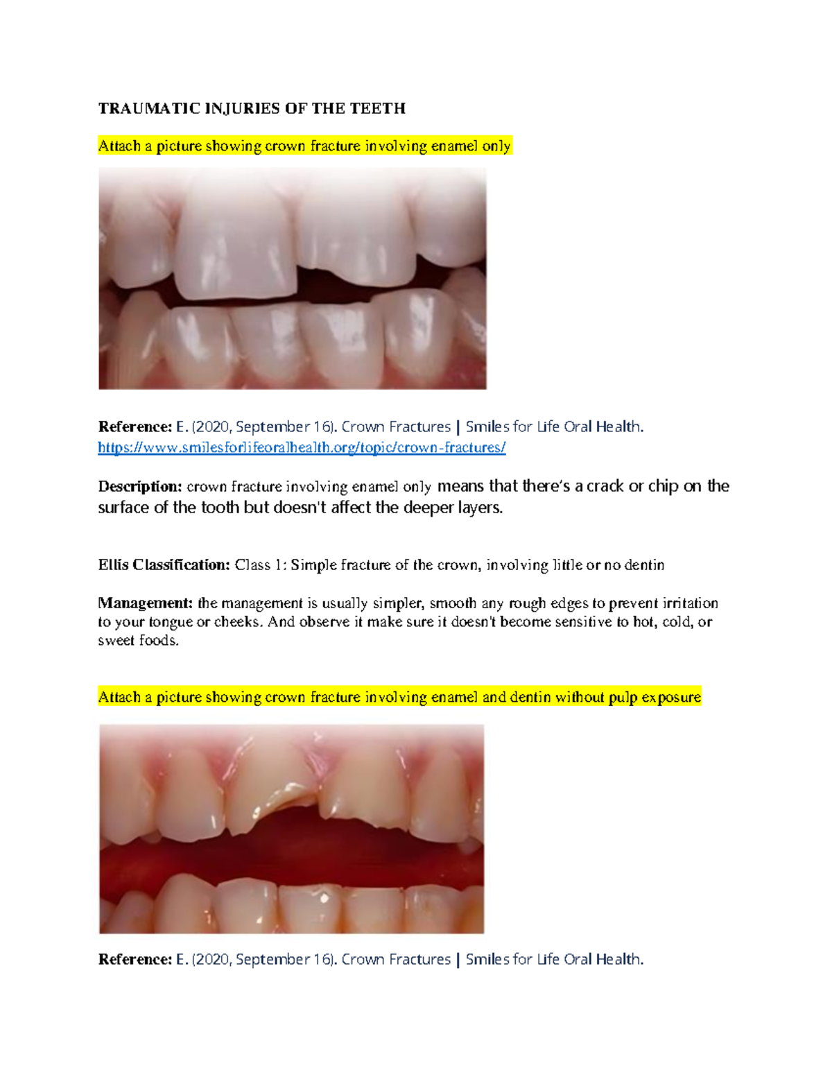 Traumatic injury opath - TRAUMATIC INJURIES OF THE TEETH Attach a ...