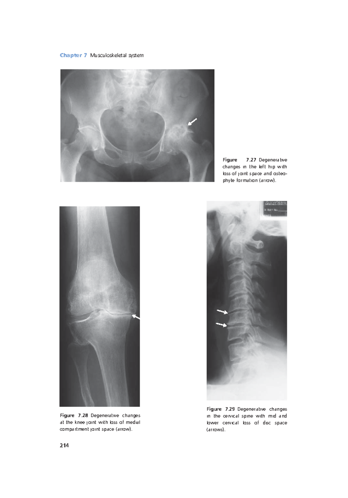 Radiology Lecture Notes pdf (72) - Chapter 7 Musculoskeletal system 214 ...