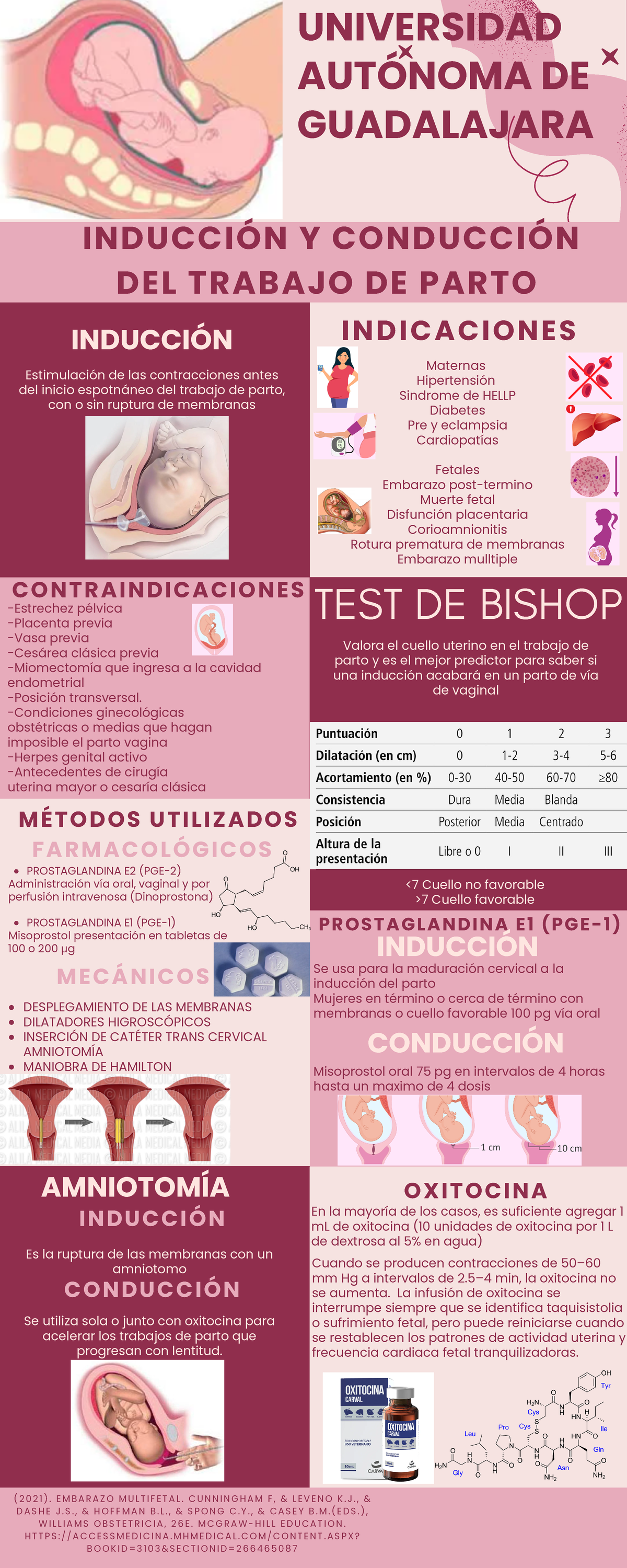 Infografía de Inducción y conducción del trabajo de parto - C O N T R A ...