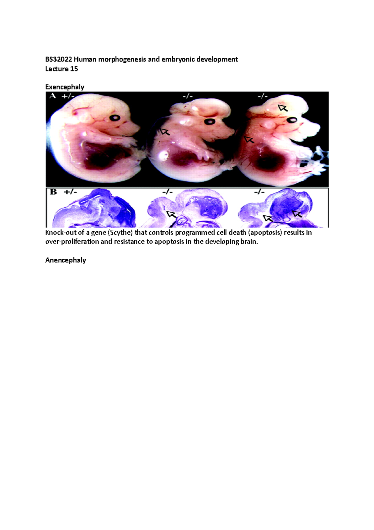Lecture 15 - part 2 - BS32022 Human morphogenesis and embryonic ...