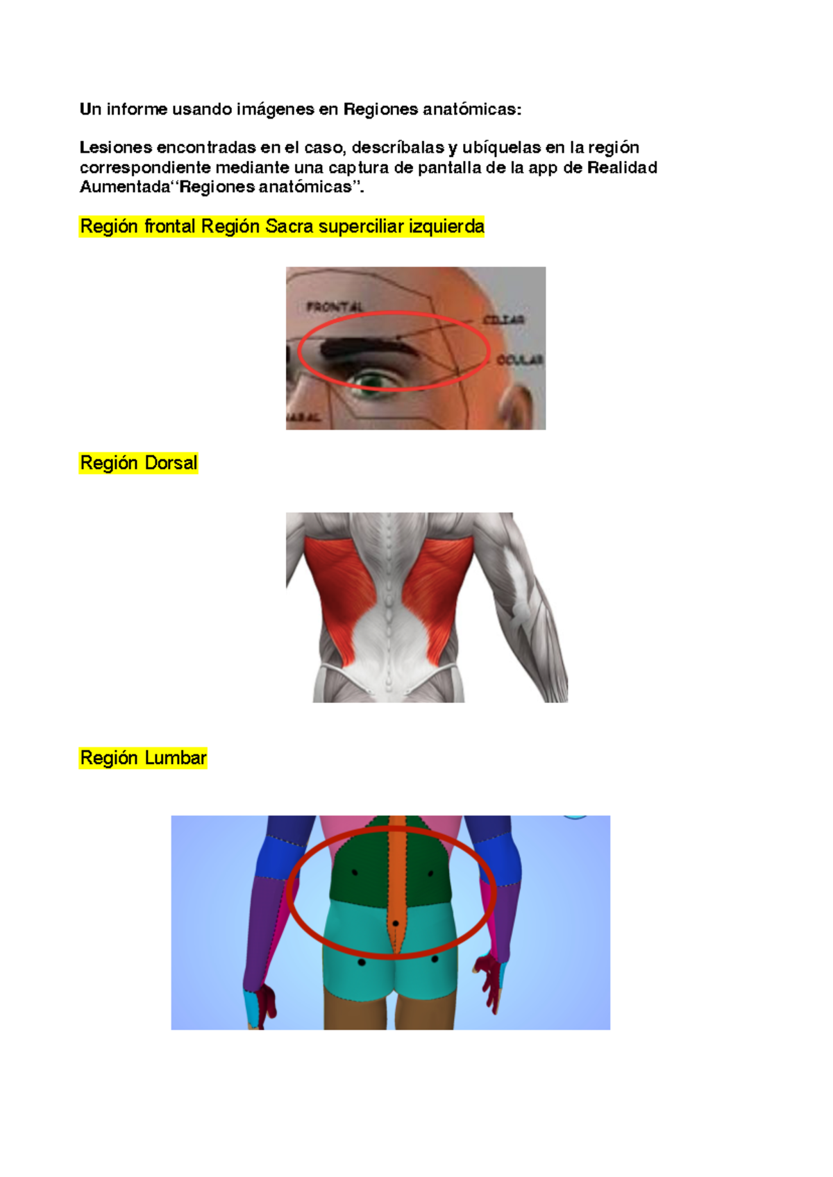 Regiones Anatómicas en Medicina Legal (ejemplos) - Un informe usando ...