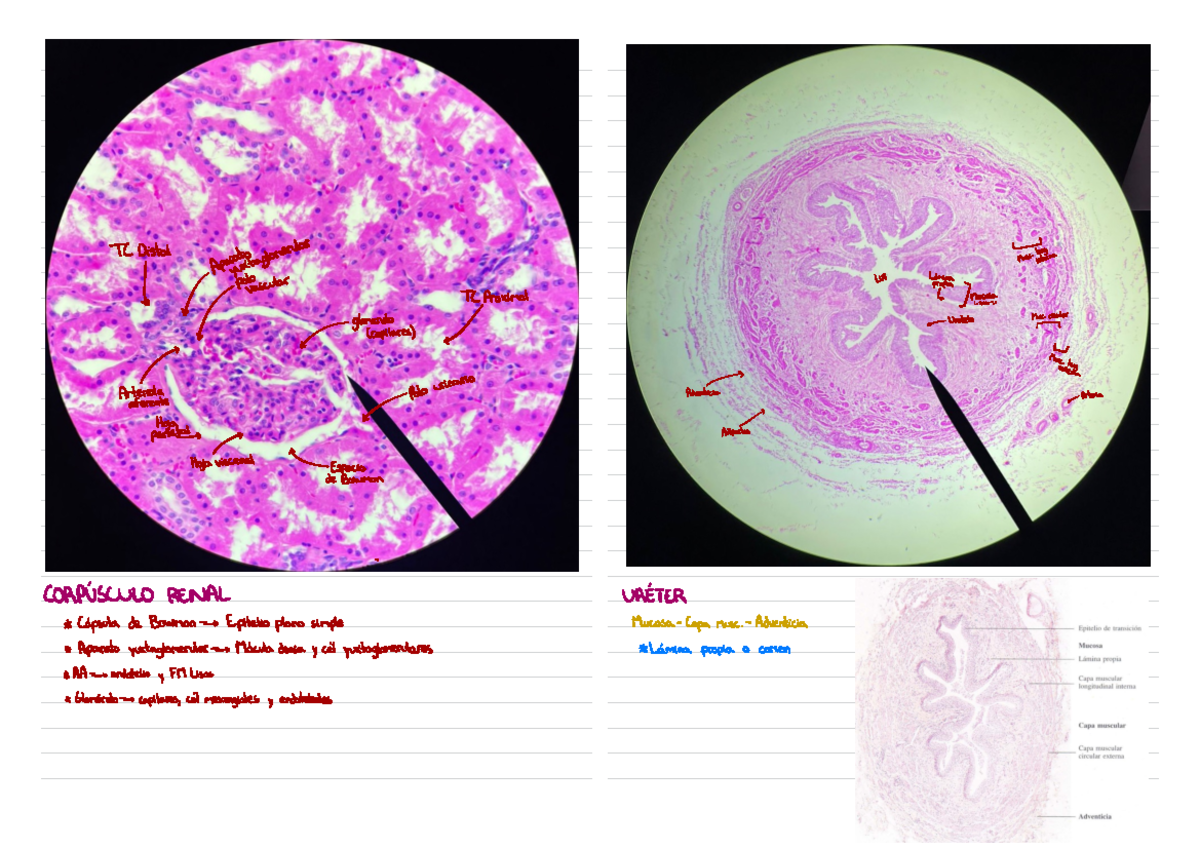 Láminas EP 2 - Uakdjskd - TC Distal to ~s. longarna Apoma [ - L ↓ ...