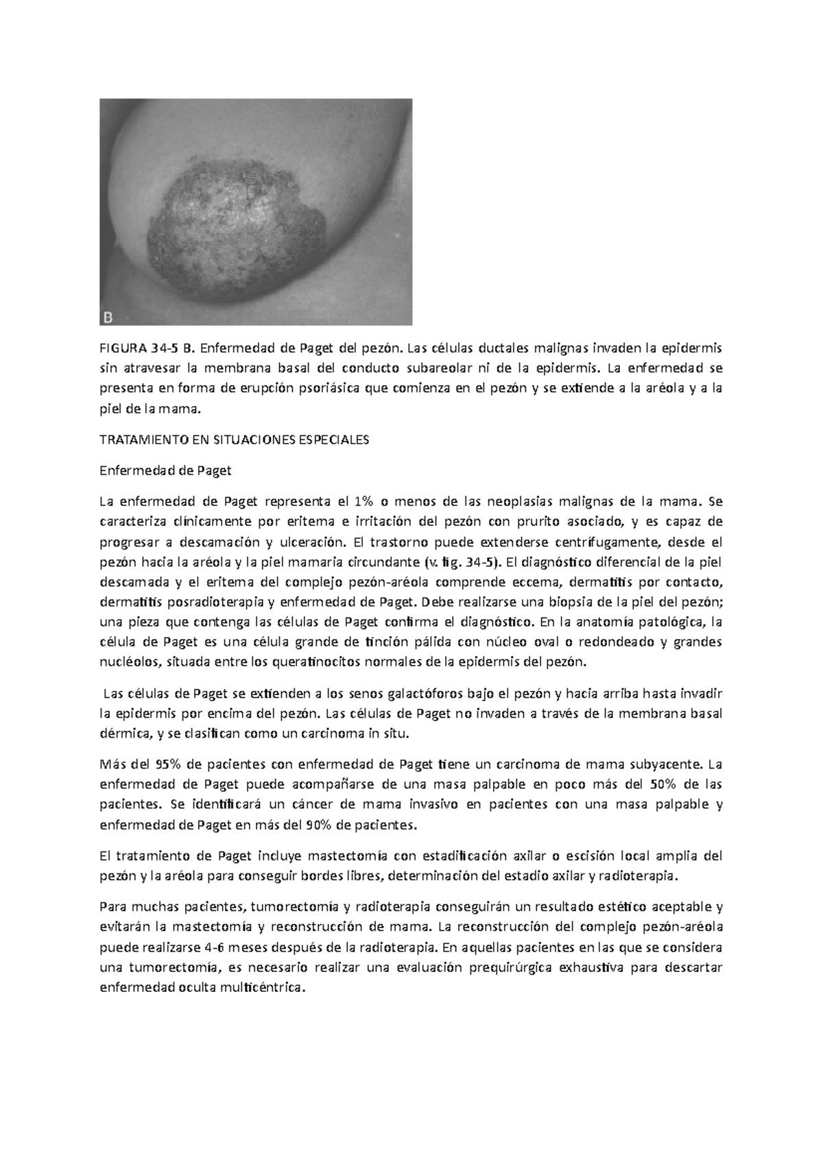 Enfermedad de Paget - kmkjnnkbhjbk - FIGURA 34-5 B. Enfermedad de Paget ...