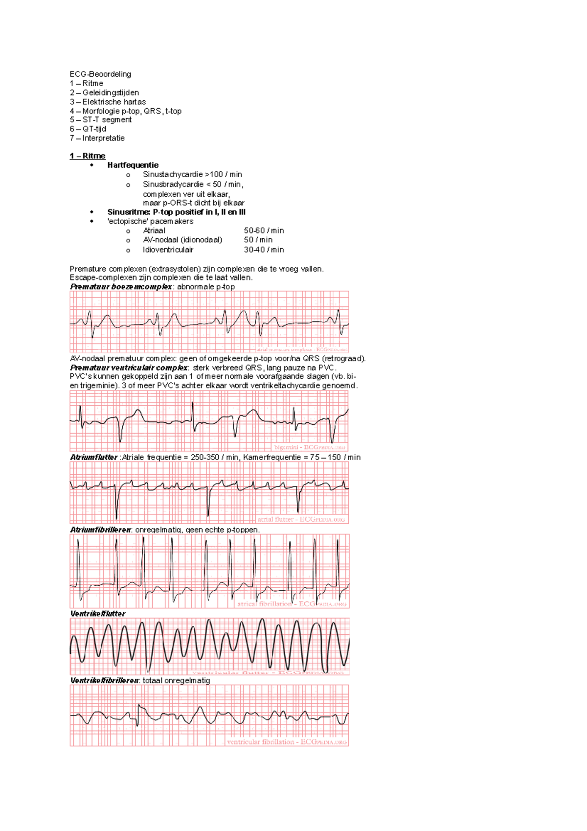 Stappenplan-ecg - uitleg over de Stappenplan-ecg - ECG-Beoordeling 1 ...