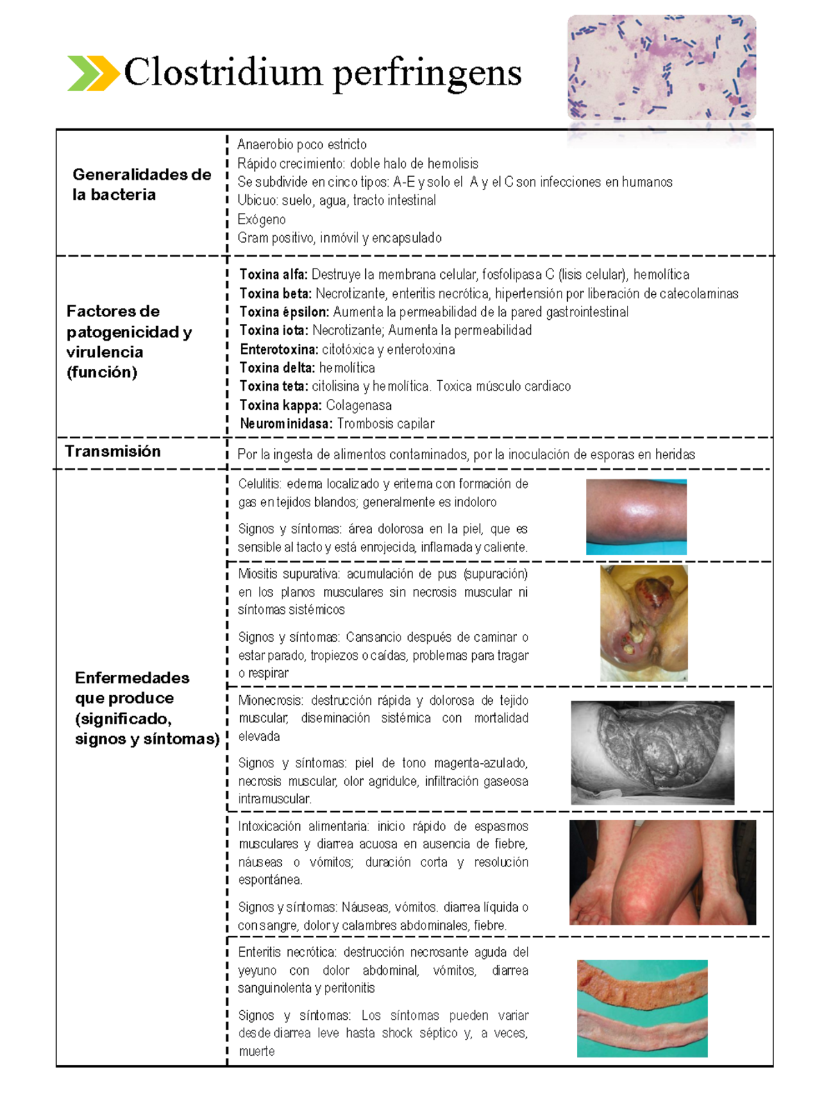 Clostridium botulinum - Clostridium perfringens Generalidades de la bacteria Factores de - Studocu
