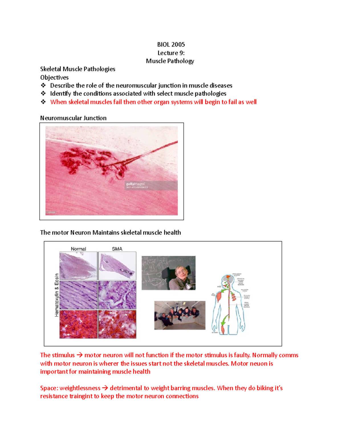 BIOL 2005 - Lecture 9 - BIOL 2005 Lecture 9: Muscle Pathology Skeletal ...
