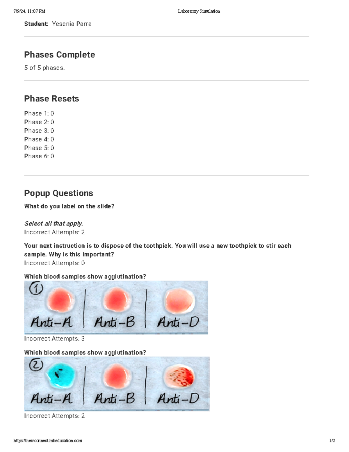 Week 10 Lab 10A Blood Typing - Student: Yesenia Parra Phases Complete 5 of 5 phases. Phase ...