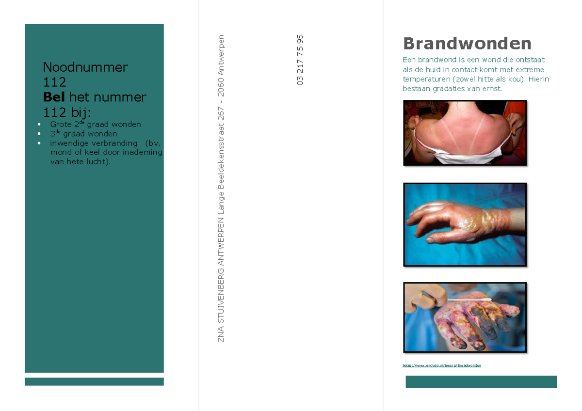 bio brochure brandwonden 3 ASO - Noodnummer 112 Bel het nummer 112 bij ...