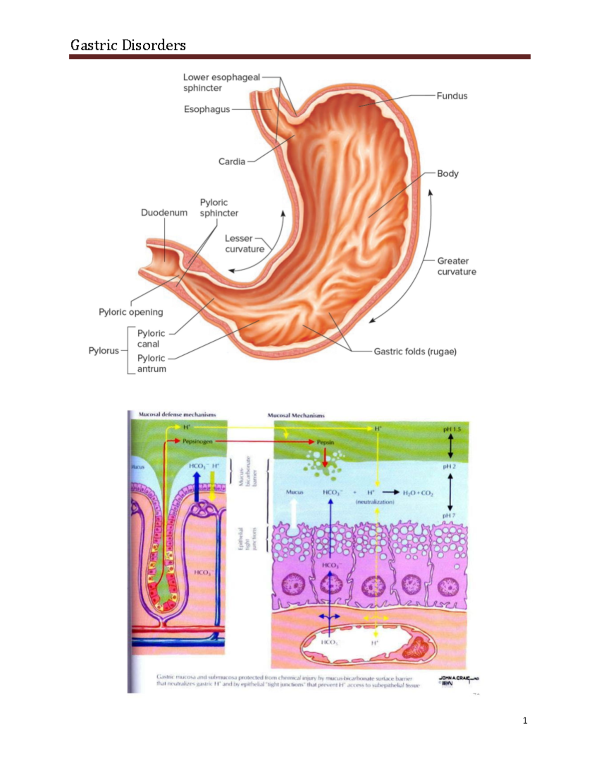 Chronic peptic ulcer I - GIT surgery - CHRONIG PEPTIC ULCER Definition ...
