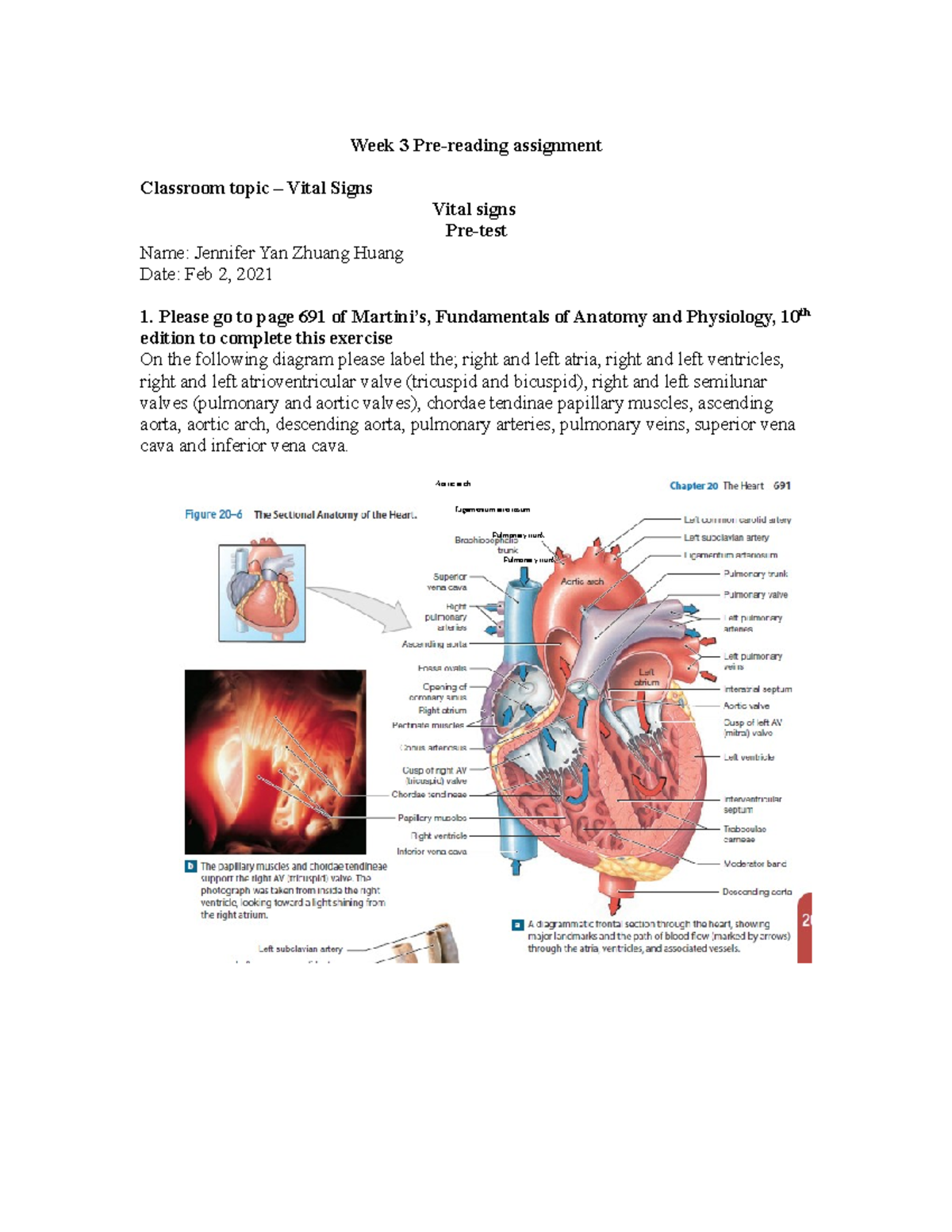 3. Vital Sign + Posture Pt 1 - Week 3 Pre-reading assignment Classroom ...