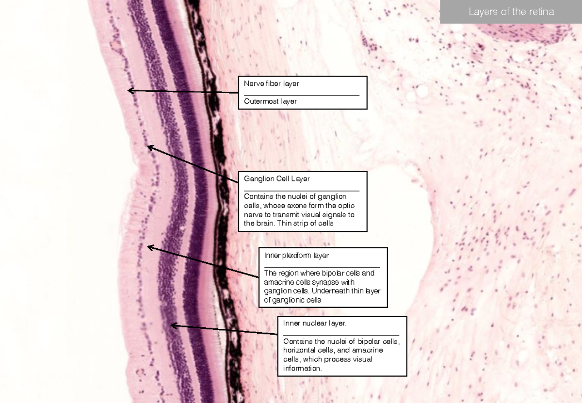 ANAT3009 Layers of the Retina - Layers of the retina Ganglion Cell ...