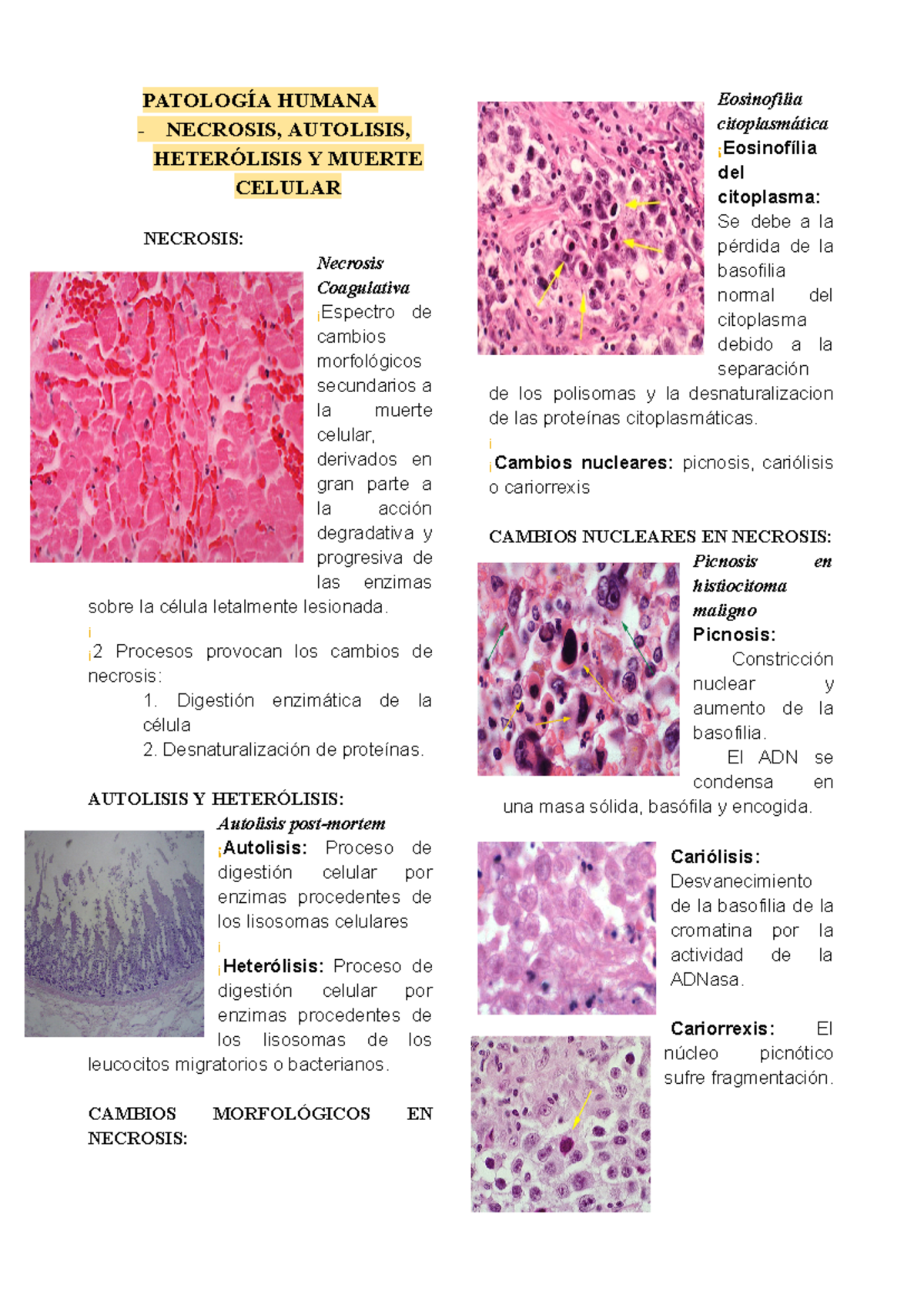 Patologia Necrosis, autolisis, heterolisis y muerte celular - PATOLOGÍA ...