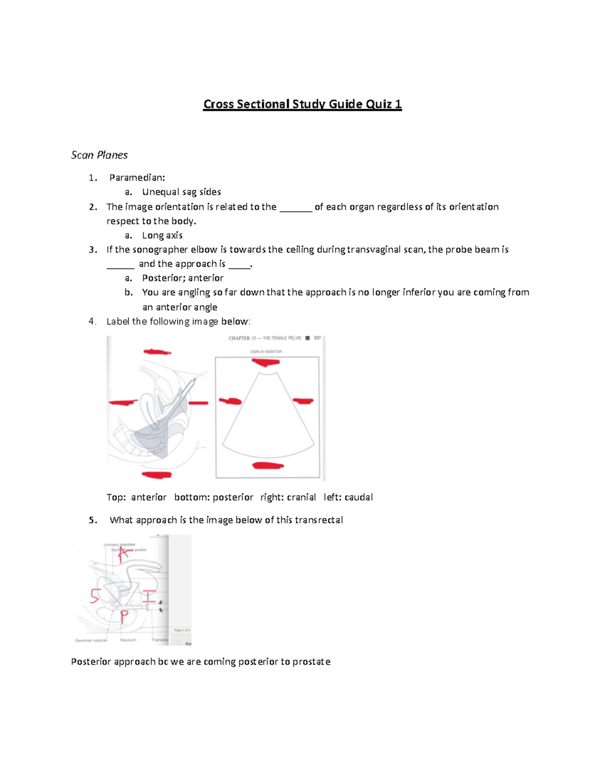 Cross Sectional III - Study Guide Quiz #1 (1) - Cross Sectional Study ...